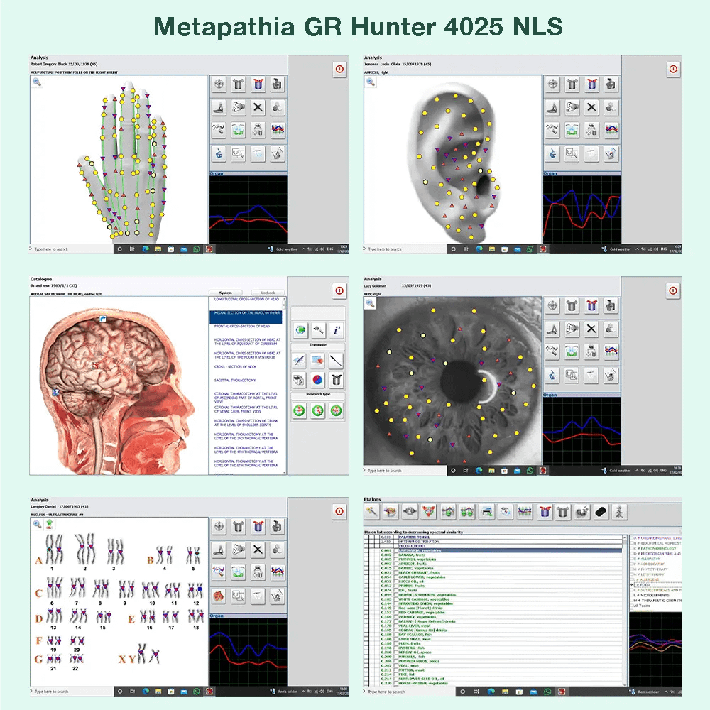 Metatron Hunter 4025 Premium Bioresonance Therapy Kit